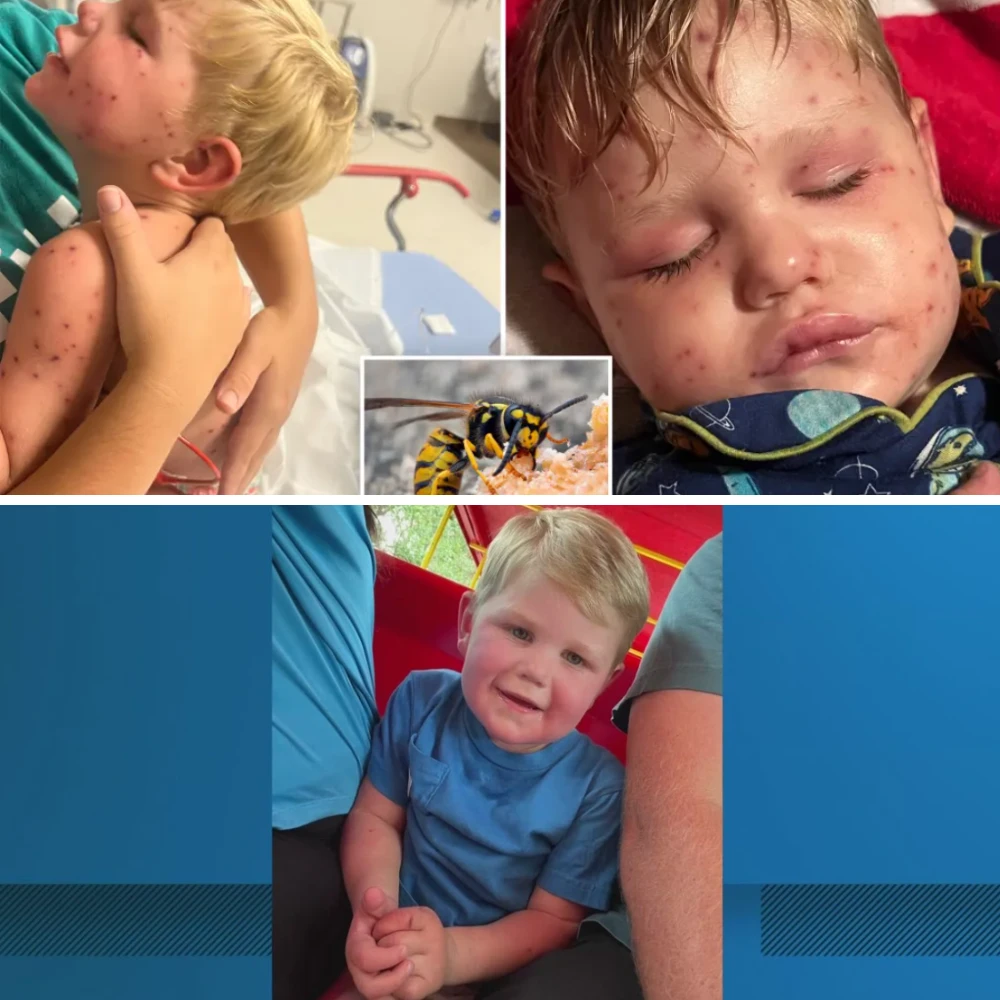 Two-year-old Beckham Reed is fighting for his life in a Georgia ...