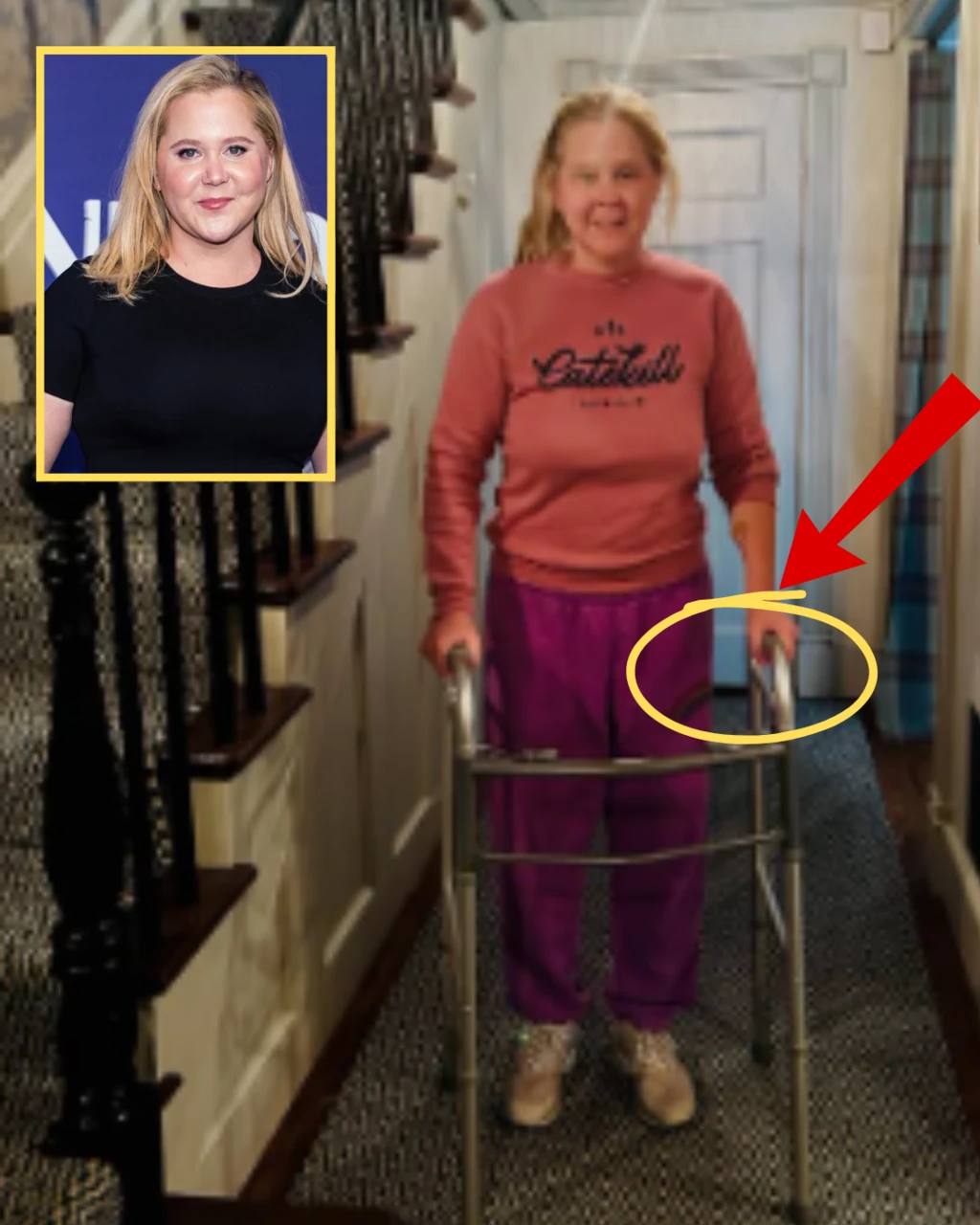 FANS IN TEARS As Amy Schumer Unexpectedly Shares SH0CKING UPDATE on Her ...