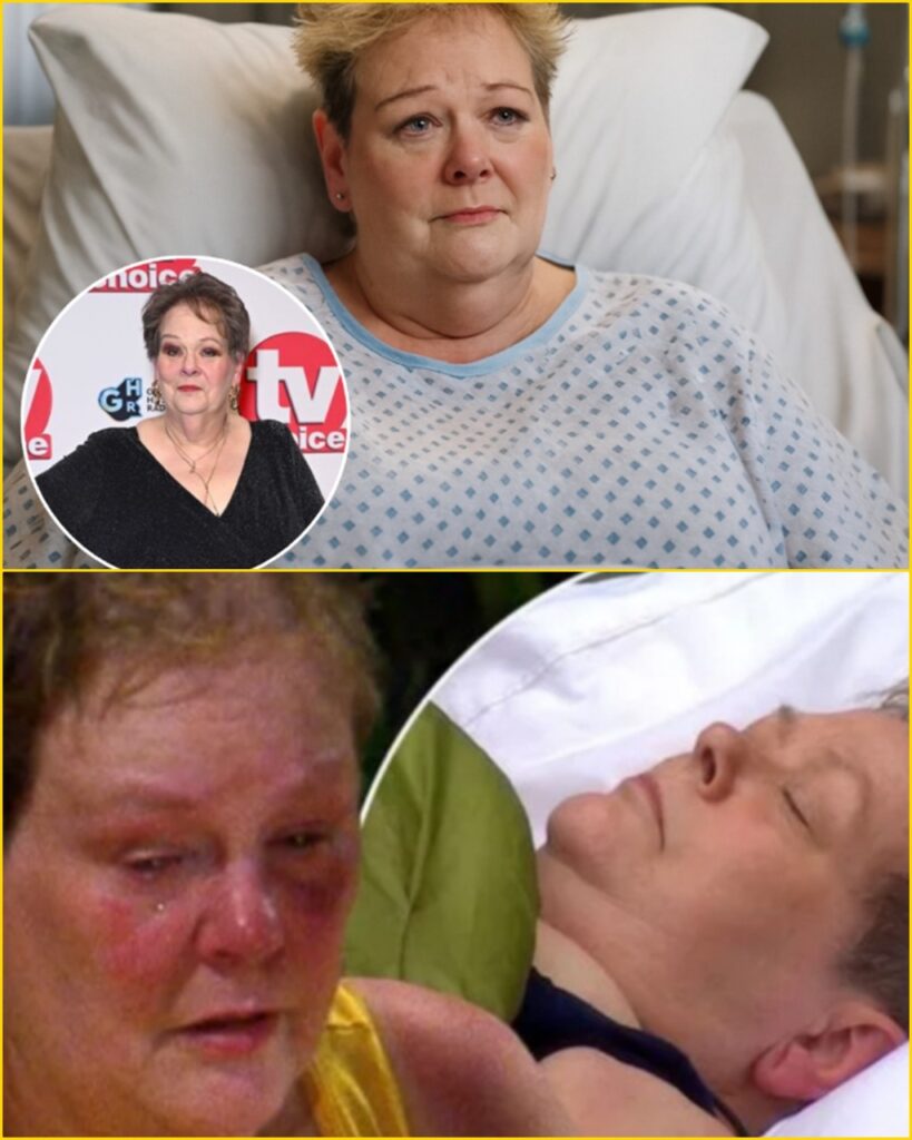 SAD NEWS: The Chase’s Anne Hegerty Issues Emergency Health Update ...